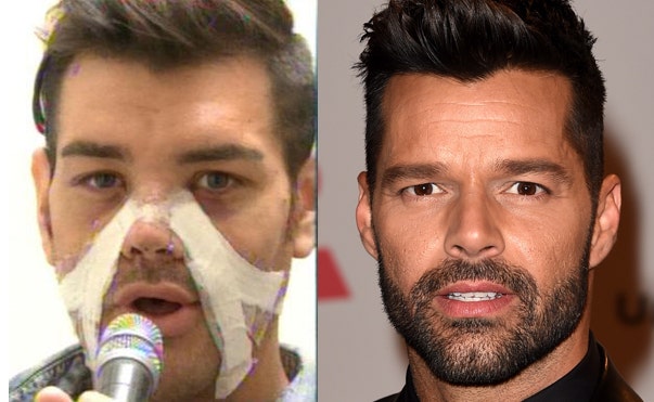 Argentinian young man gets surgery to look like Ricky Martin | Fox News