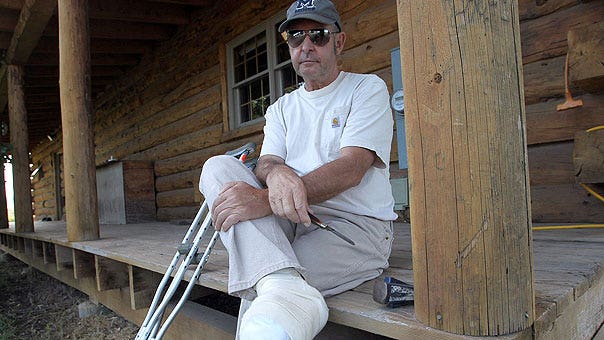 Colorado Logger Cuts Off Toes After Foot Is Pinned | Fox News