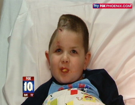 3-Year-Old Gunshot Victim's Skull Preserved in Abdomen | Fox News