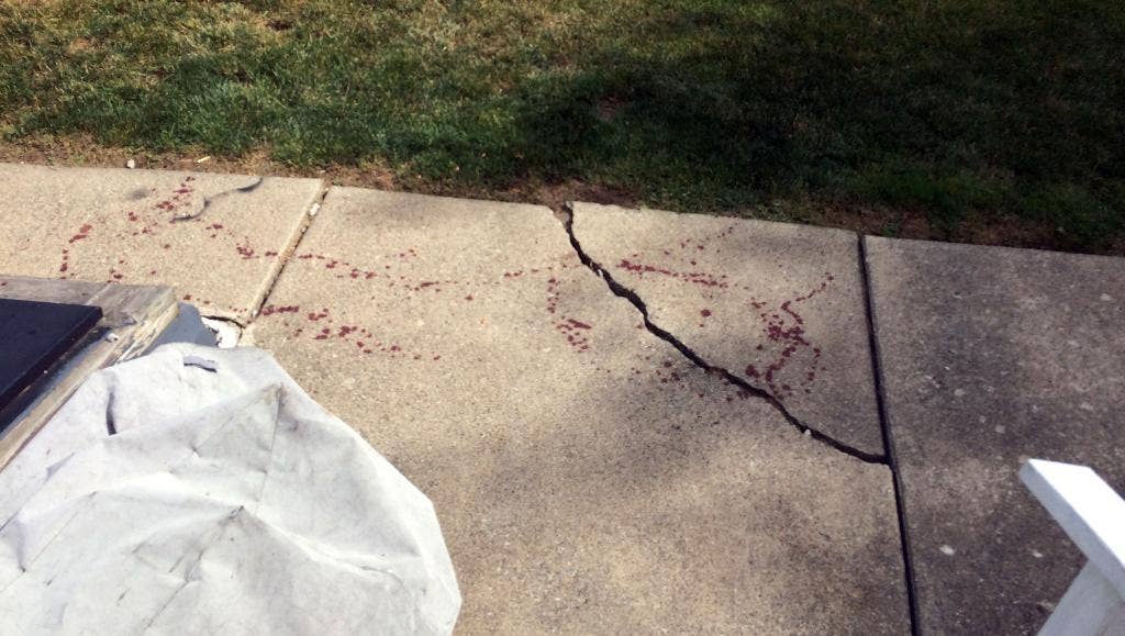 Suspect's hand cut off with machete during home invasion | Fox News