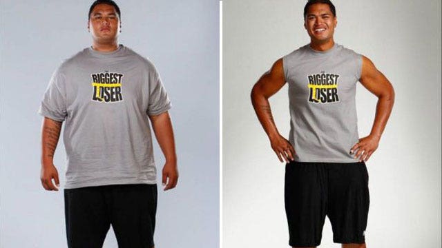 'Biggest Loser' Contestant in Critical Condition After Falling Several ...