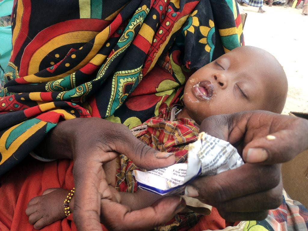 Global Hunger Index: Calamitous famines vanish, hunger levels decline ...