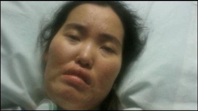 Woman who won right to die has change of heart, stays on life support ...