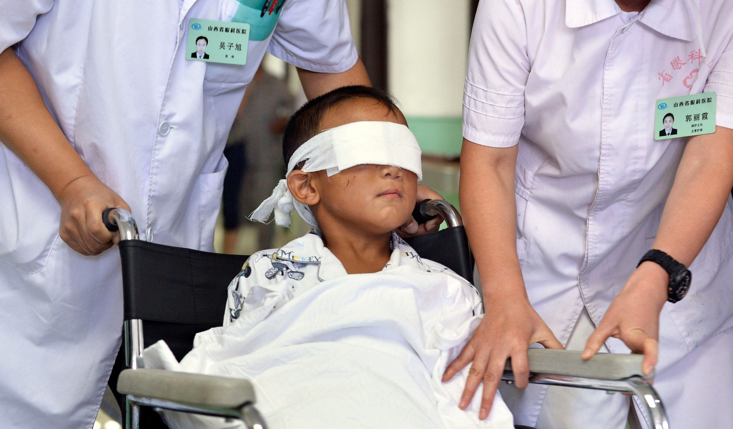 Chinese boy whose eyes were gouged out by attacker is getting implants ...