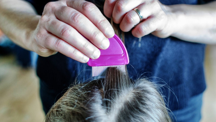 'Super lice' outbreak hits 25 states | Fox News