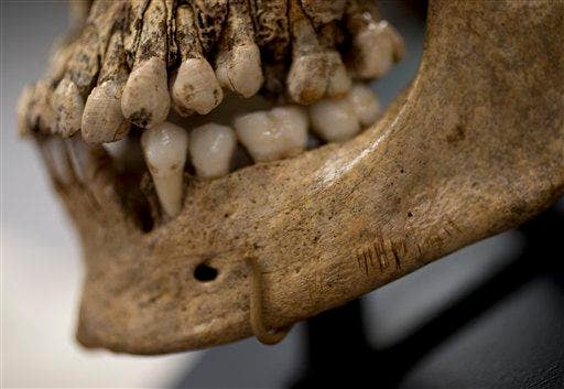 Here's why cannibalism is bad for your health | Fox News