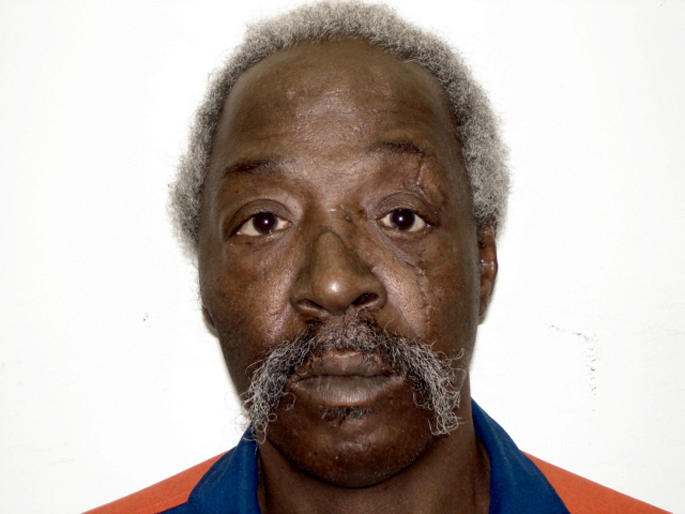 Ex-Inmate Can Sue for Cruel and Unusual Punishment Over No Toothpaste ...