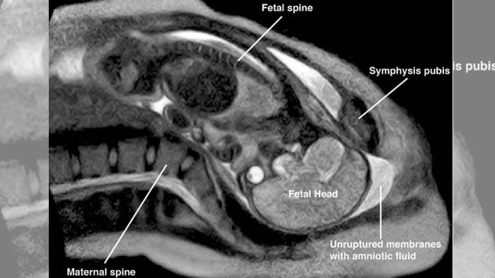 First ever MRI video captures baby's birth | Fox News