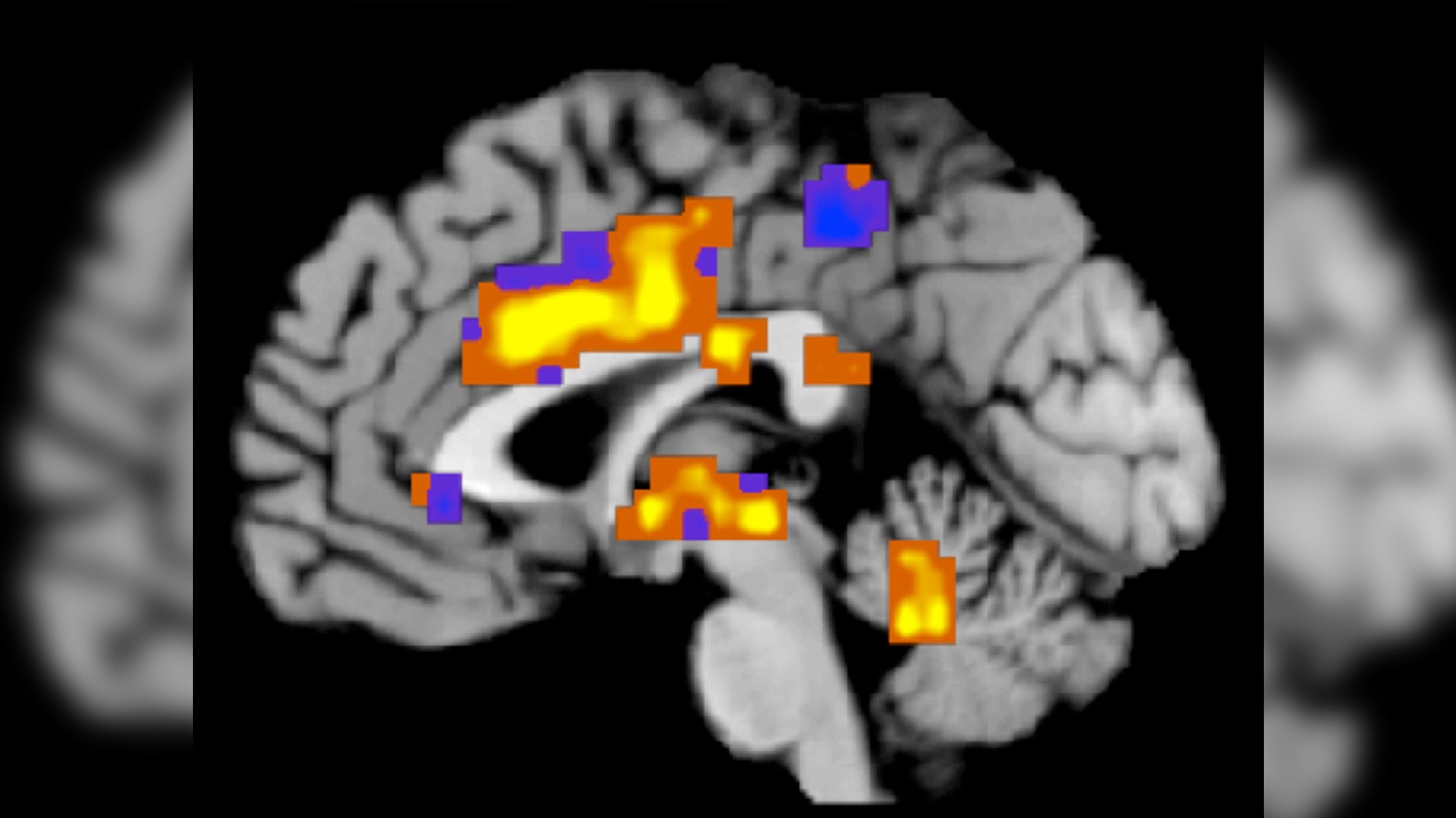 Doctors use brain scans to 'see' and measure pain | Fox News