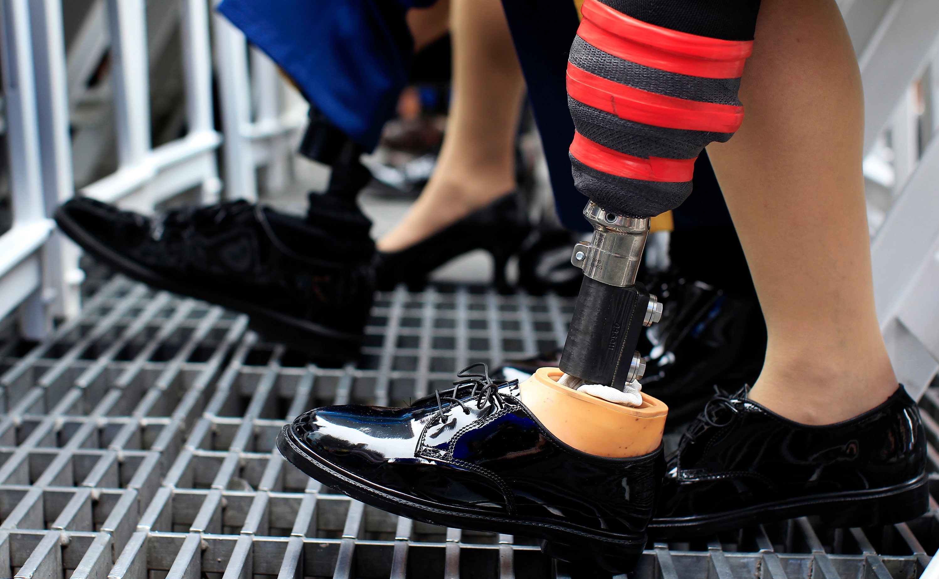 How the mind adjusts to lost limbs | Fox News