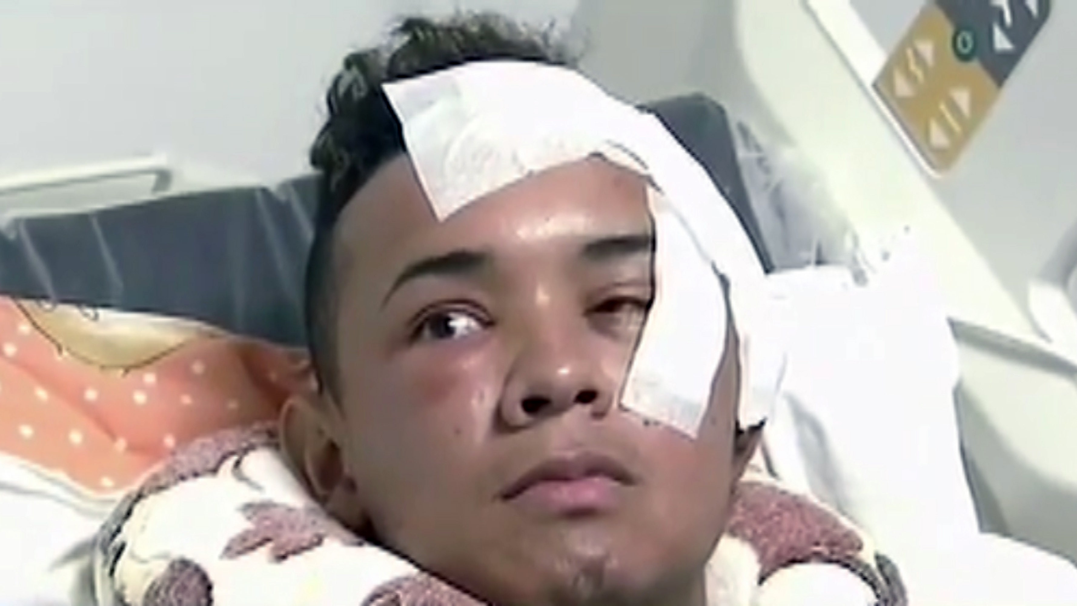 Man survives knife in eye socket | Fox News