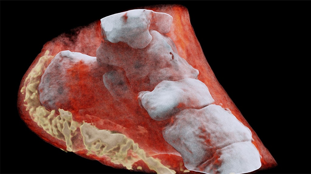 First-ever color X-rays deliver astonishingly clear pictures for more ...