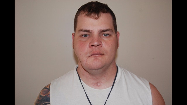 Georgia veteran to undergo surgery decade after being shot in face ...