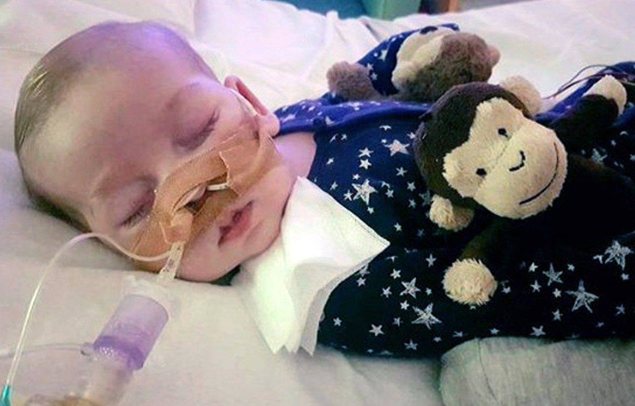 Parents of brain-damaged baby lose fight to keep him on life support ...
