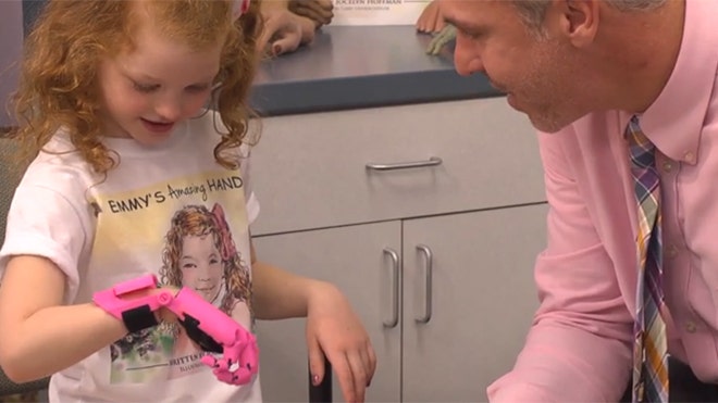 Pennsylvania girl with congenital condition gets 3-D printed fingers ...