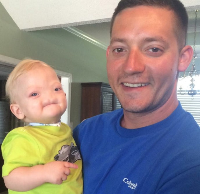 'Miracle baby' born without a nose dies at age 2, family says | Fox News