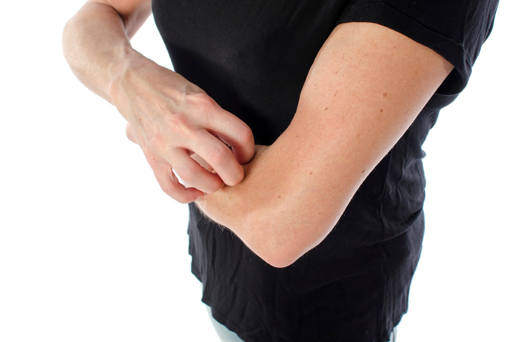 5 nasty skin conditions you can pick up at the gym | Fox News