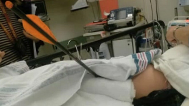 8-year-old shot with arrow during UC Berkeley field trip | Fox News