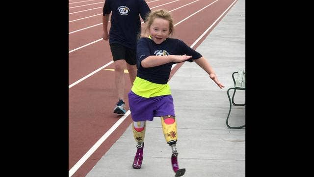 9-year-old fitted with new prosthetics after home is destroyed in ...