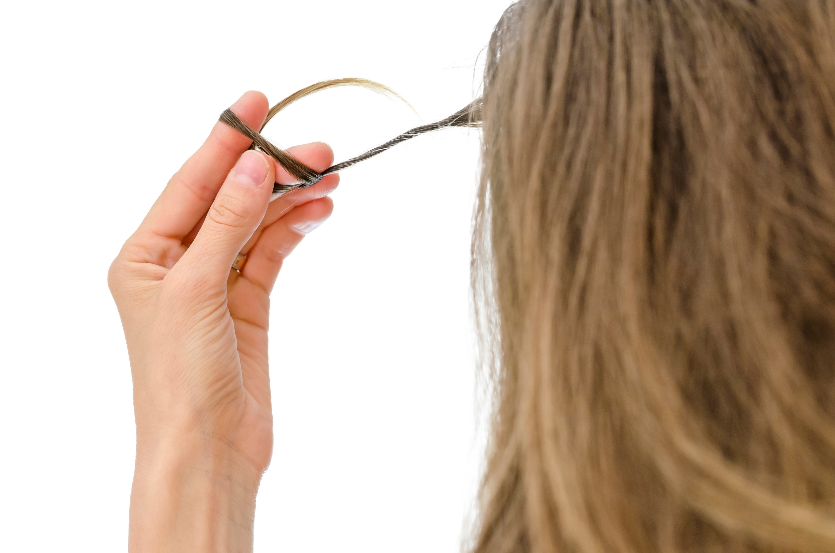 Rapunzel Syndrome Caused Womans Odd Symptoms Fox News