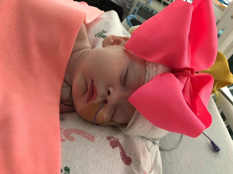 Baby severely injured in softball accident breathing on her own | Fox News