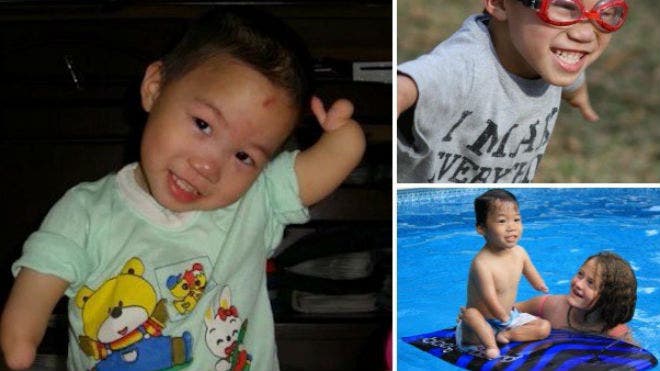 Boy born without arms and legs thriving in Georgia | Fox News