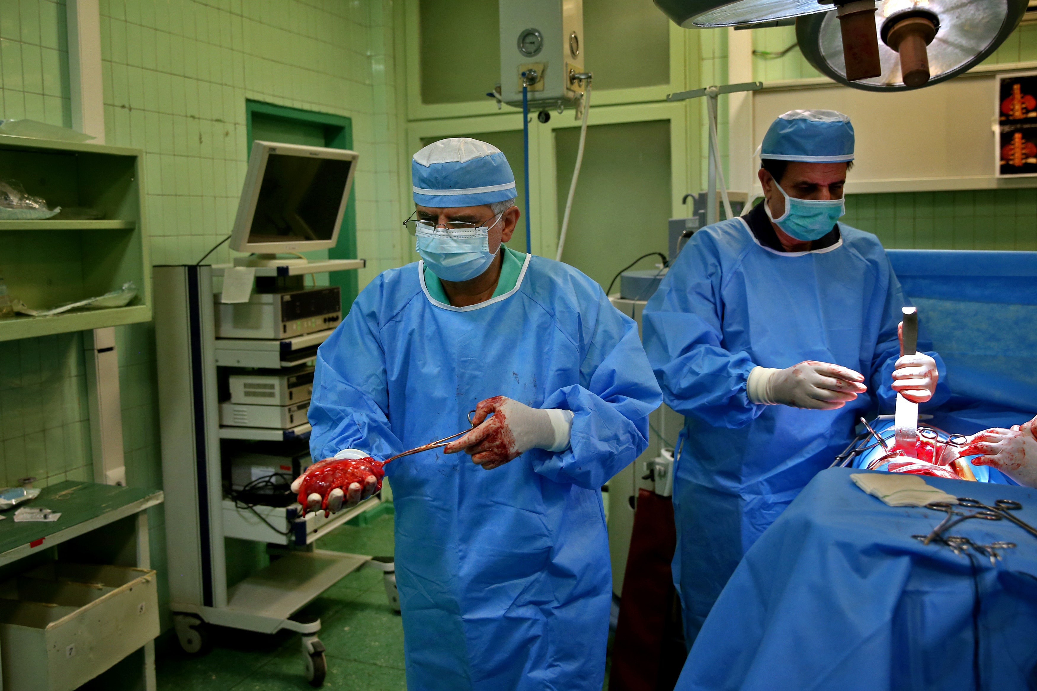 In Iran, unique system allows payments for kidney donors | Fox News