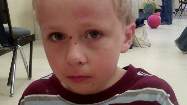 Volunteers Join Search for Missing Autistic Boy in Virginia | Fox News