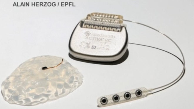 Paralyzed monkeys walk again with wireless 'brain-spine interface ...