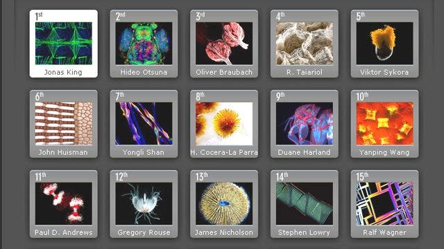 Life As You've Never Seen It: 2010's Best Microscope Photos | Fox News