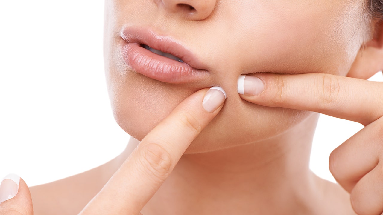 This woman's pimple turned out to be a dangerous staph infection | Fox News