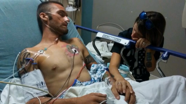 Man recovering after being electrocuted by power lines | Fox News