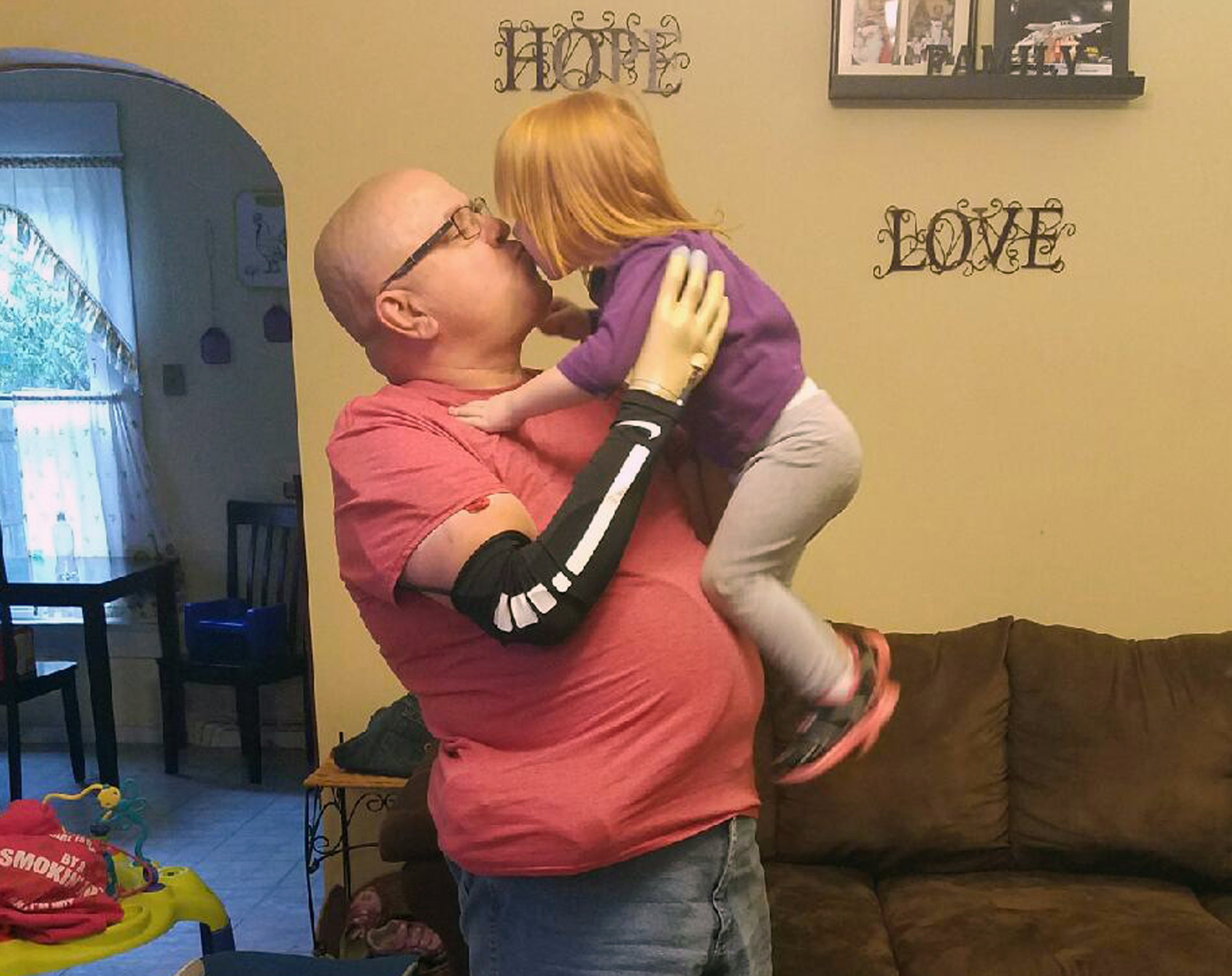 Artificial hand helps amputees feel just how hard to squeeze | Fox News