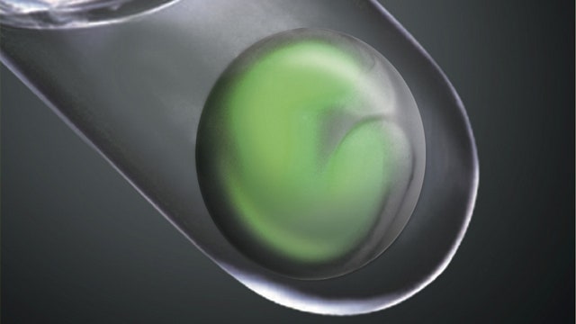 Real Retinas Grown in Lab Hold Eye Transplant Promise | Fox News