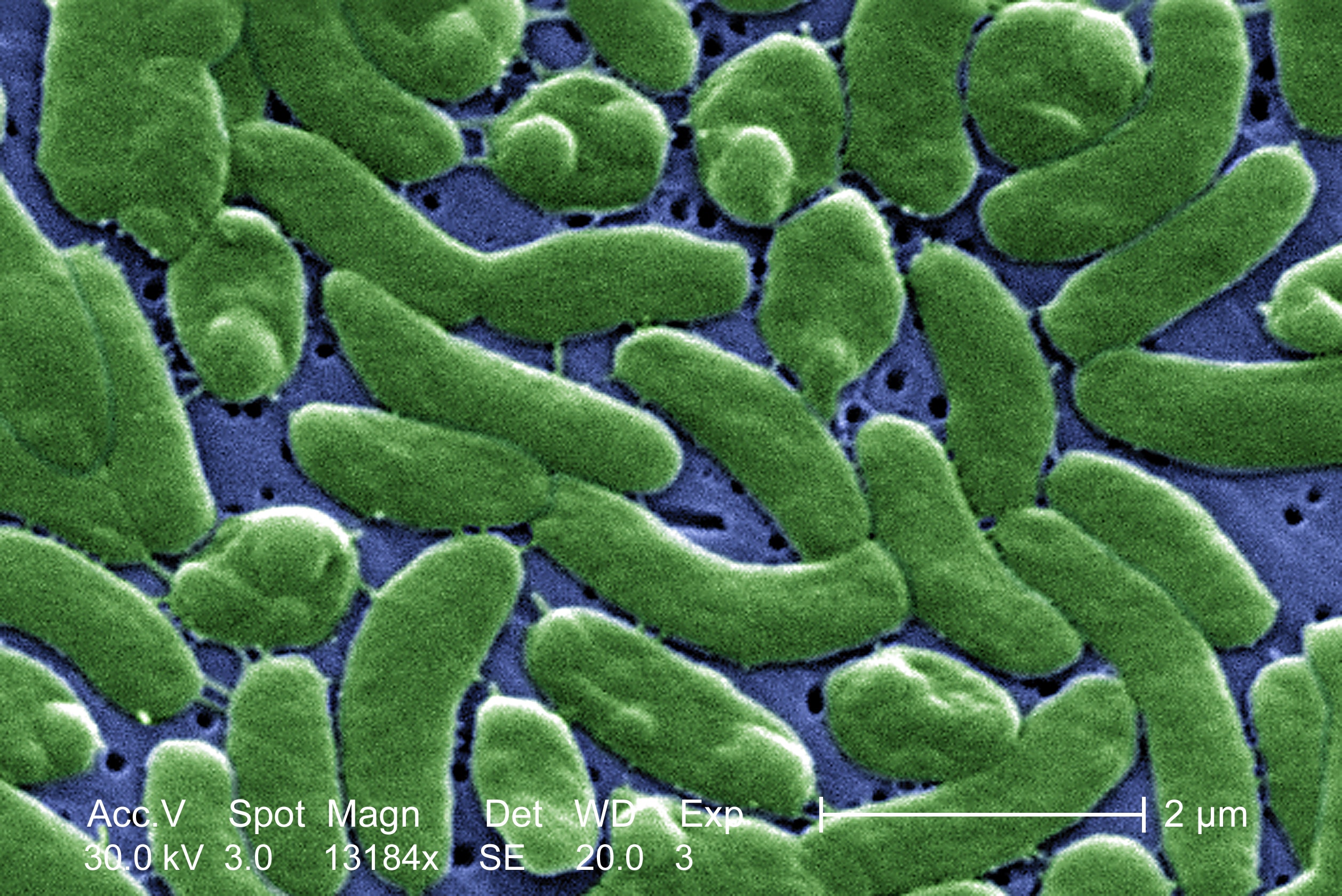 Florida officials warn of deadly seawater bacteria after man's death ...