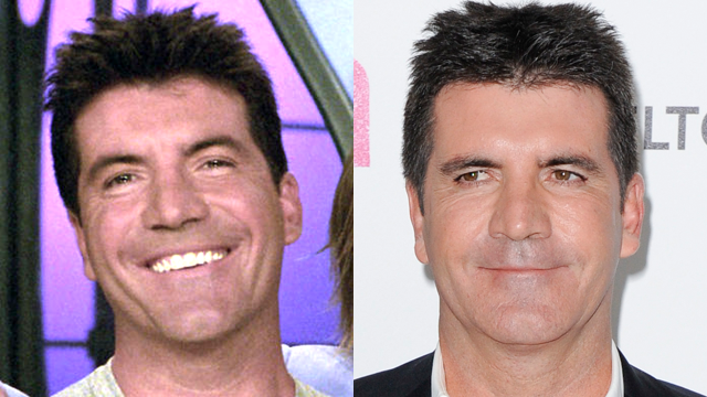 Simon Cowell's Hairstory: From Fuzzy to Buzzy | Fox News