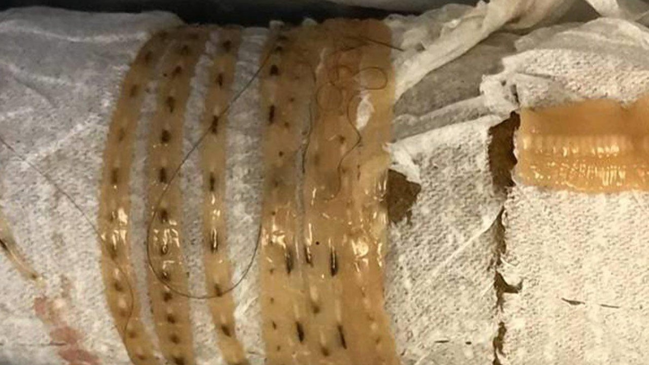 Five-foot long tapeworm came 'wiggling out' of man's body after he ate ...