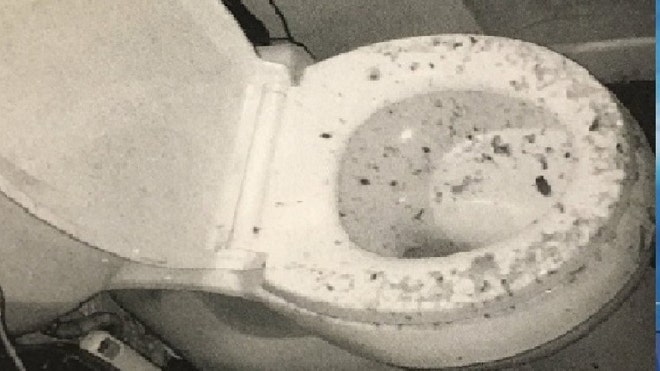 Baltimore woman injured by exploding toilet files lawsuit | Fox News