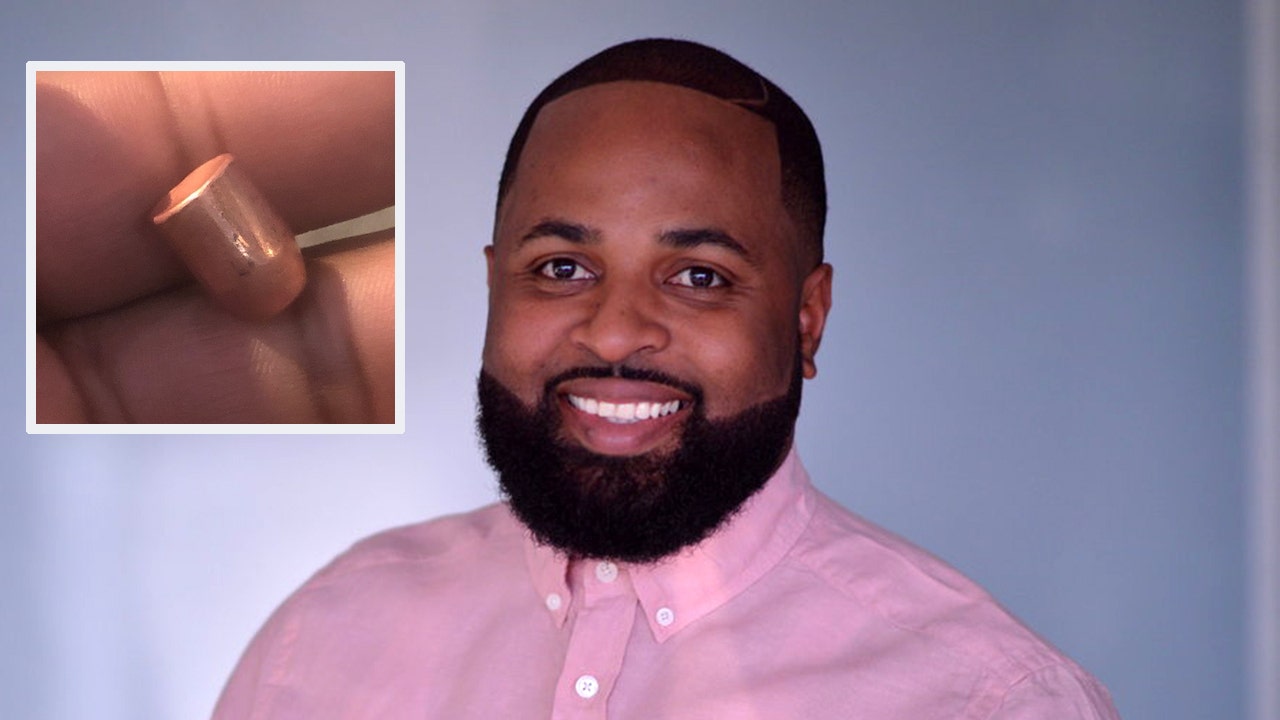 Texas pastor delivers sermon holding bullet that had just narrowly ...