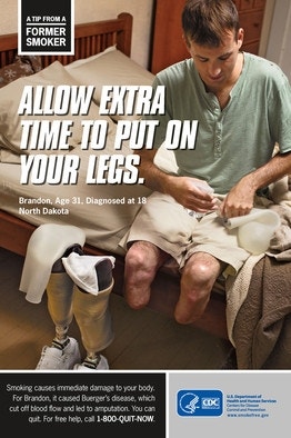 CDC Unveils Graphic Anti-Smoking Campaign | News